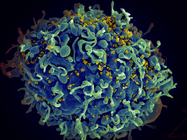 Low level HIV Viremia Definitions Predictors Mechanisms And Low level HIV Viremia Definitions Predictors Mechanisms And