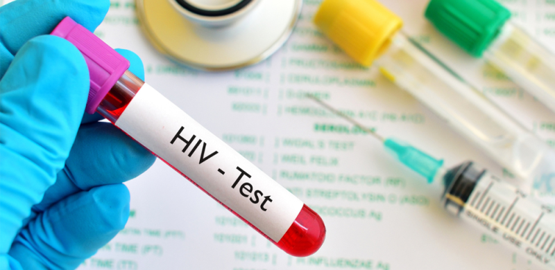 Cost-effective strategies of testing for HIV and sexually transmitted ...